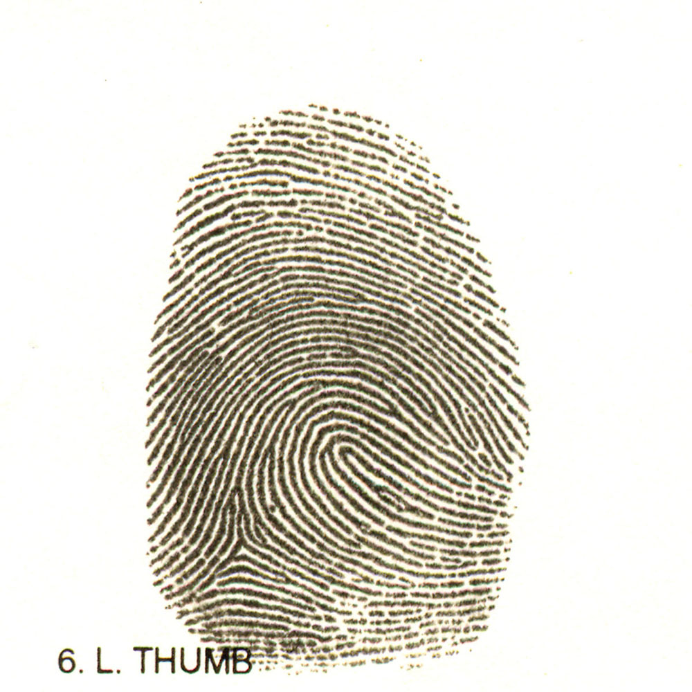 Postmortem Fingerprint Kit | EVIDENT Postmortem Fingerprint Kit | EVIDENT